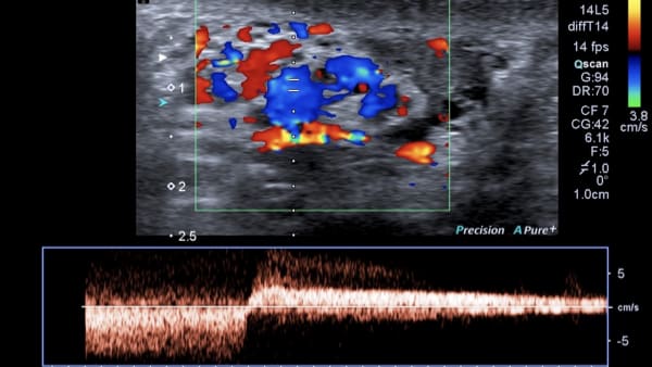 Imagerie masculine (échographie prostatique Paris) - Imagerie Paris 13