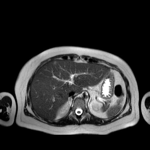 Imagerie par Résonance Magnétique (IRM Paris) - Imagerie Paris 13